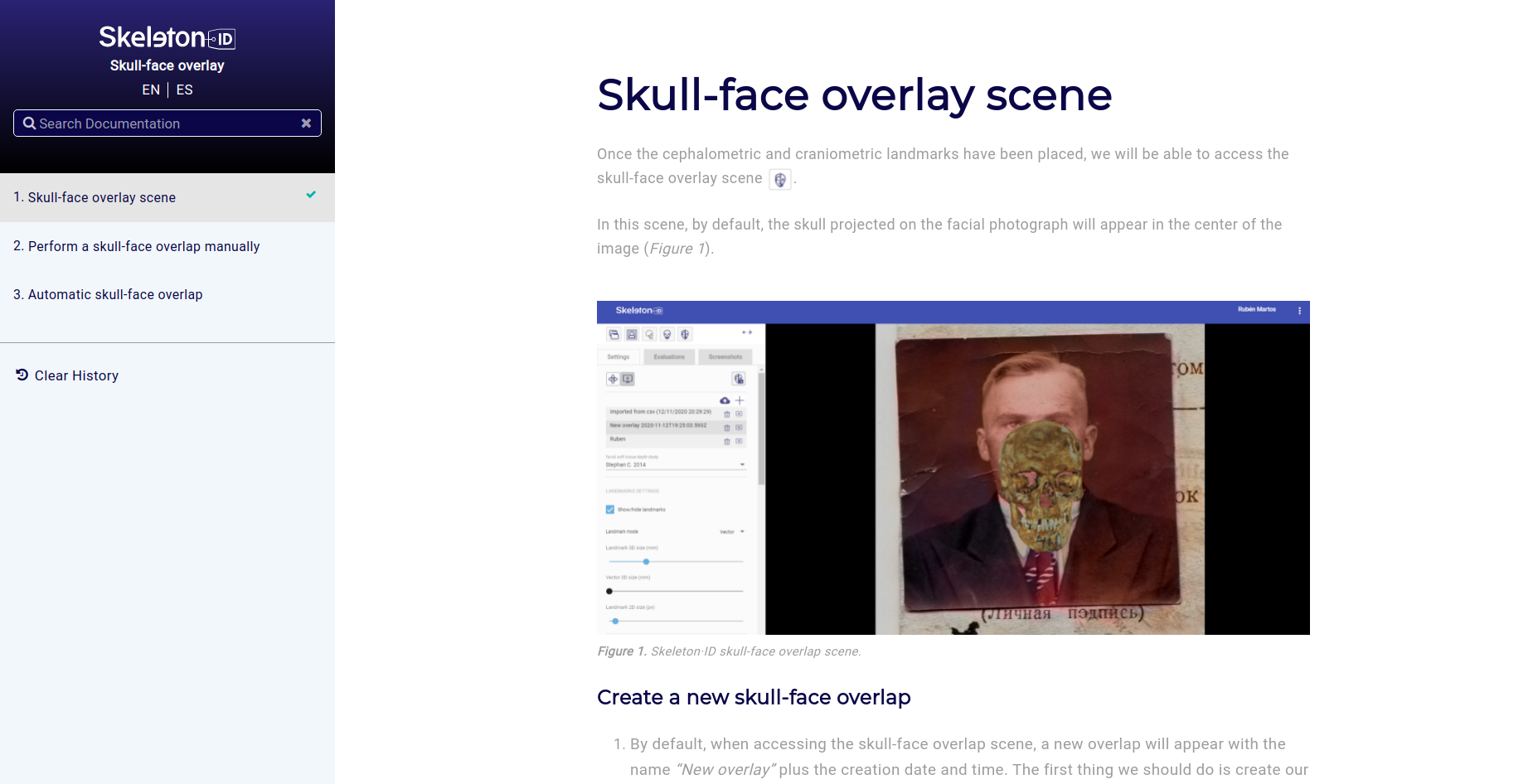 Skull-face overlay - Skeleton·ID