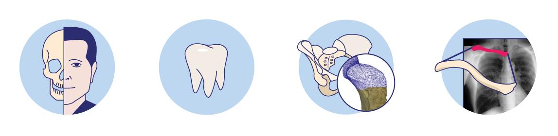 Victims of migrations - Skeleton·ID